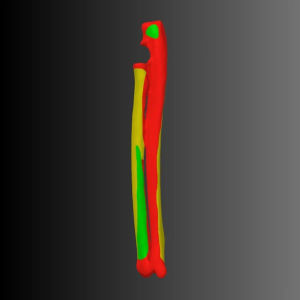 Anatomical model of the radius and ulna of a cat (bone map) – Bio3Dtech ...
